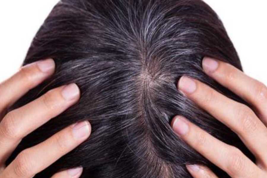 Rambut Uban | BALIPOST.com